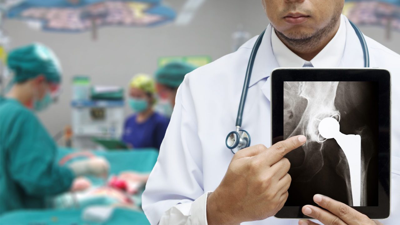 Heup operatie Duitsland - MedicoHelp hulp bij zorg in het buitenland