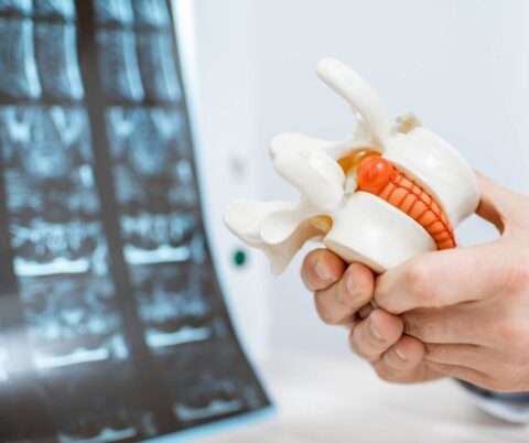 Hernia operatie Duitsland - MedicoHelp hulp bij zorg in het buitenland